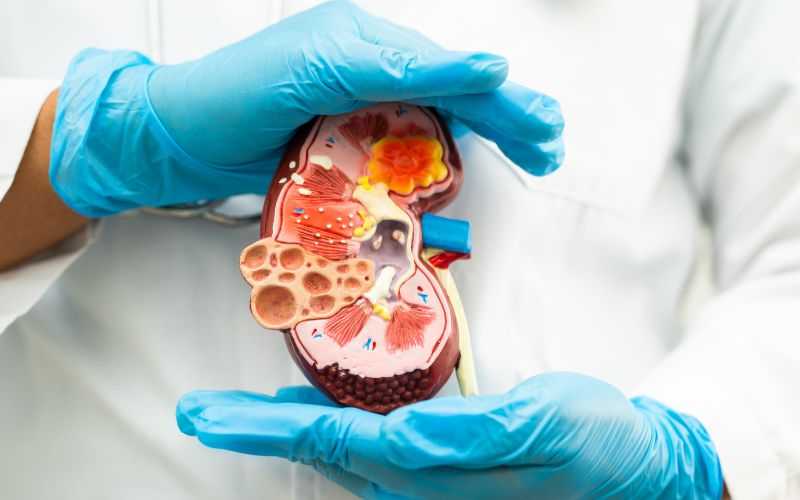 Incontinencia urinaria en pacientes con enfermedades renales